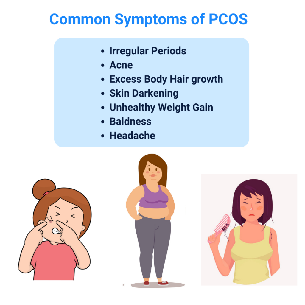 Polycystic Ovary Syndrome - PCOS Symptoms And Treatment